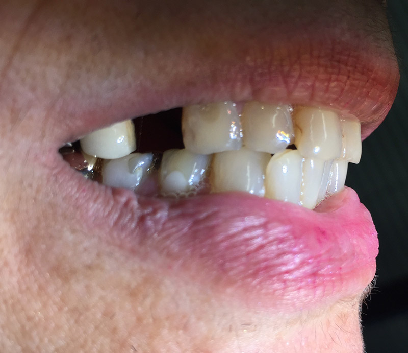 Gallery in Great Neck, NY | Great Neck Dental Care